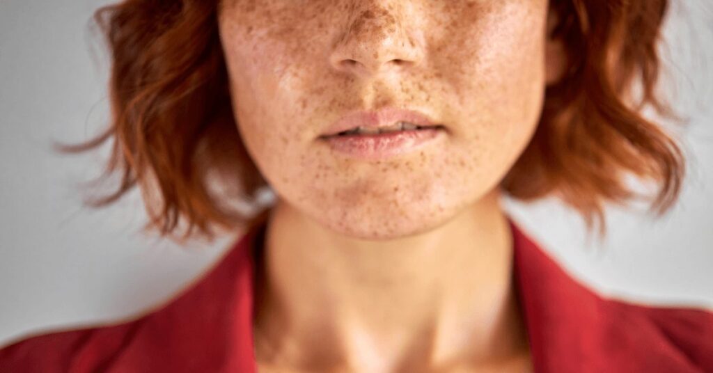 Pigmentation & Skin Tone | Australian Skin Clinics