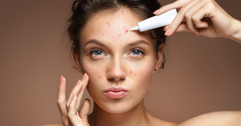 9 Surprising reasons you might have bad skin | Australian Skin Clinics