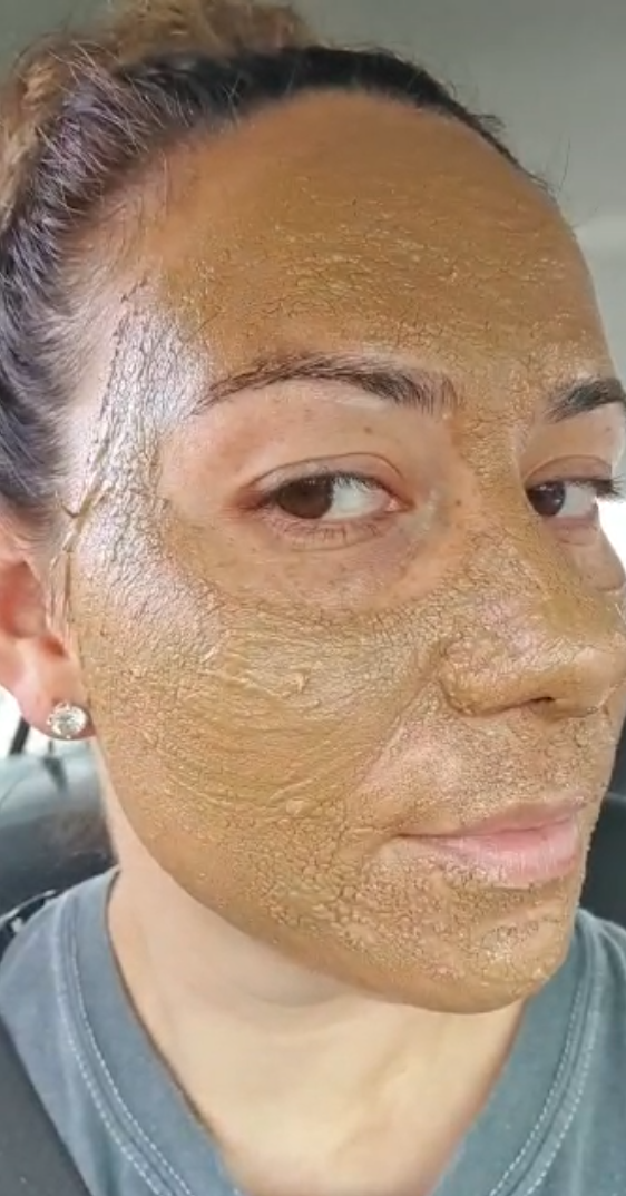 I tried the cosmelan peel: here is what to expect during your ...