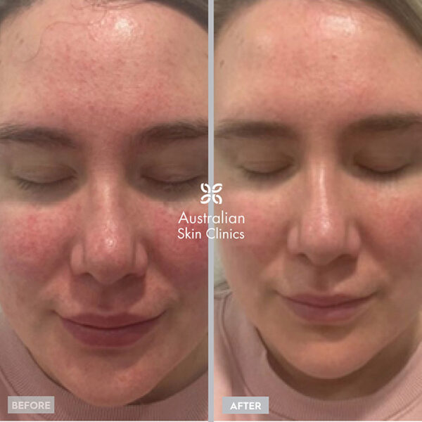 Lumixa - Australian Skin Clinics