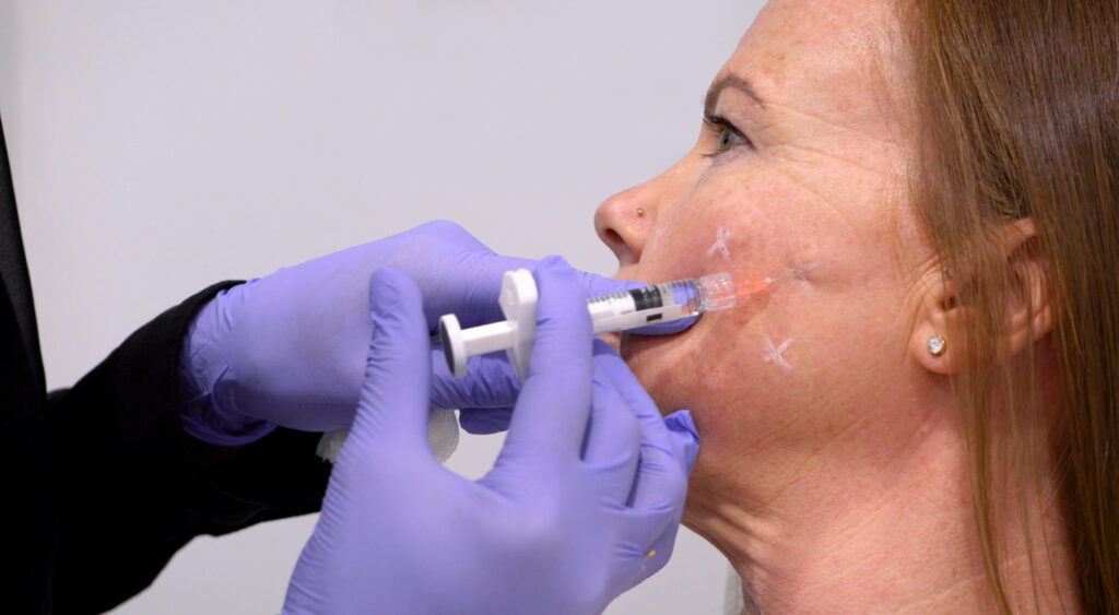 Ageing - Australian Skin Clinics