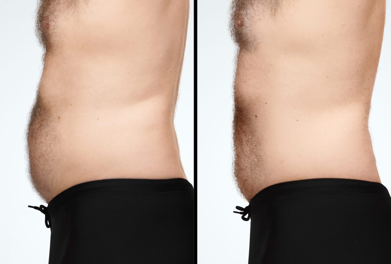 Non-Surgical Fat Reduction | Australian Skin Clinics