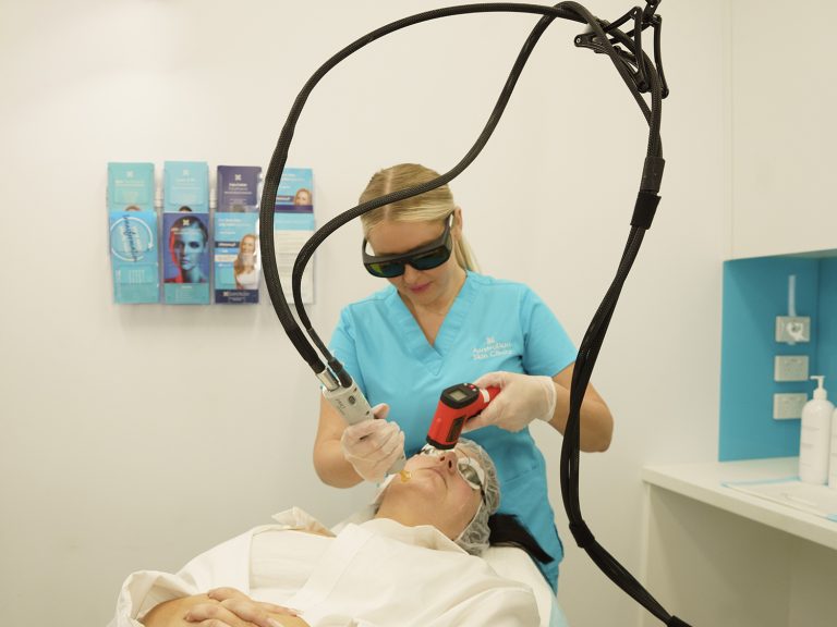 Laser Skin Rejuvenation | Australian Skin Clinics