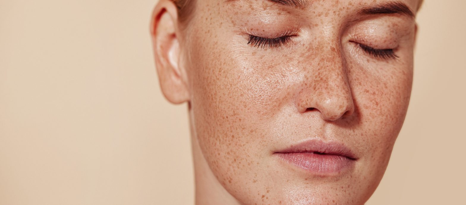 9 Surprising reasons you might have bad skin | Australian Skin Clinics